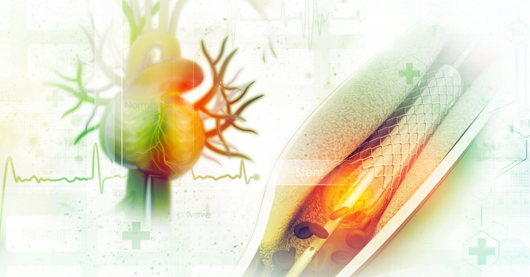 Know the different types of Angioplasty