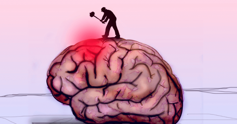 Understanding the migraine patterns and their types