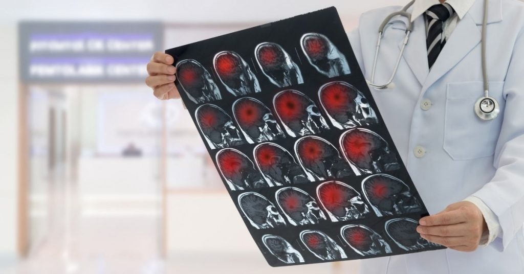 How to help a stroke patient during an emergency? | Sri Ramakrishna ...