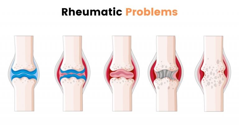 What are the types of rheumatic problems? | Sri Ramakrishna Hospital