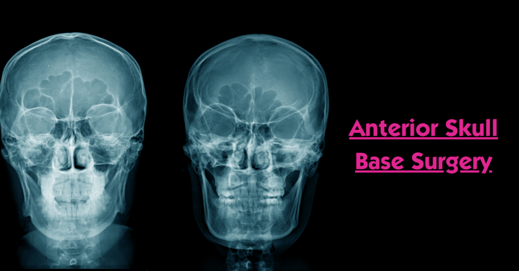 How to Prepare for Anterior Skull-Base Surgery? | Sri Ramakrishna Hospital