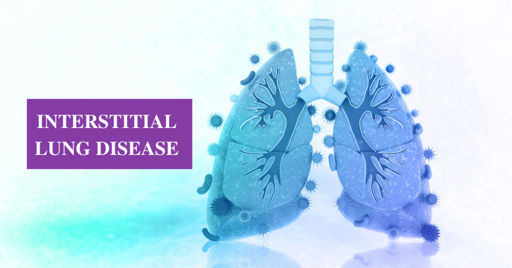 Why we need to care about interstitial lung disease? | Sri Ramakrishna ...