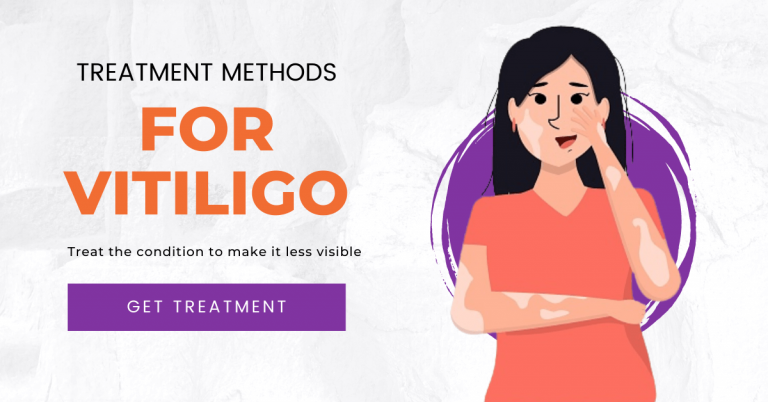 What treatment could be a breakthrough for vitiligo? | Sri Ramakrishna ...