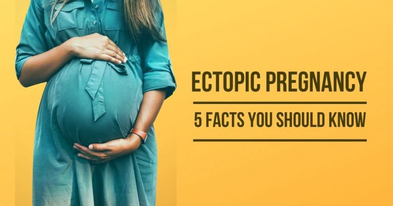 Ectopic Pregnancy - 5 Facts You Should Know | Sri Ramakrishna Hospital