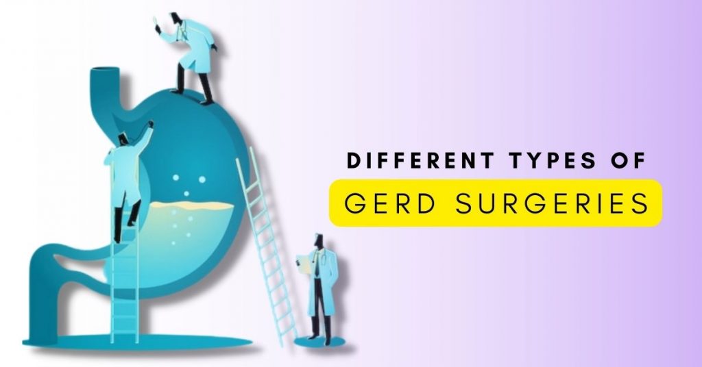 GERD: What Patients Should Know and How Their Surgeons Can Help