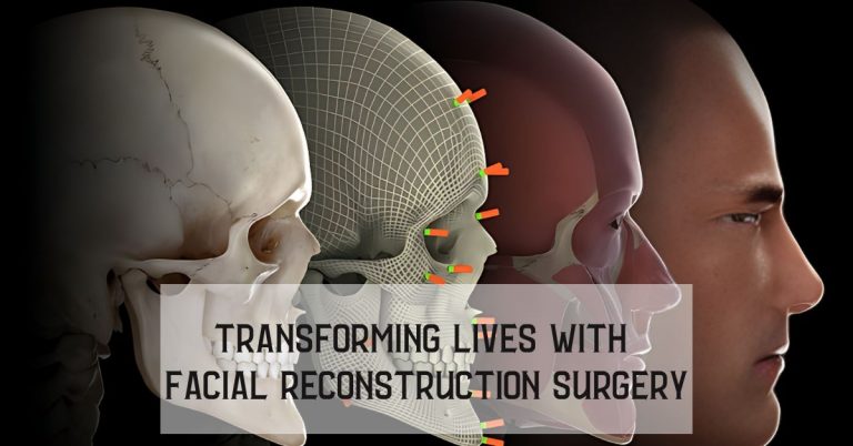A New Beginning: How Facial Reconstruction Surgery Can Help You Start ...