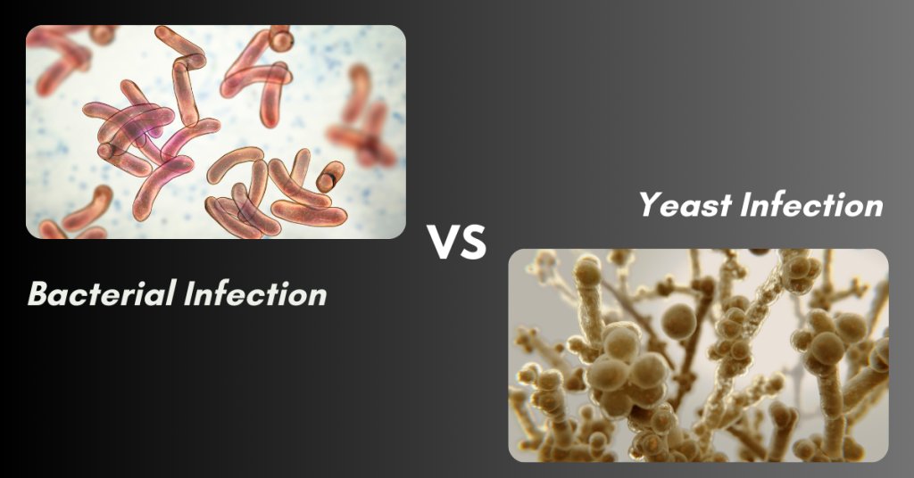 Are Bacterial Infection And Yeast Infection The Same Sri Ramakrishna Hospital