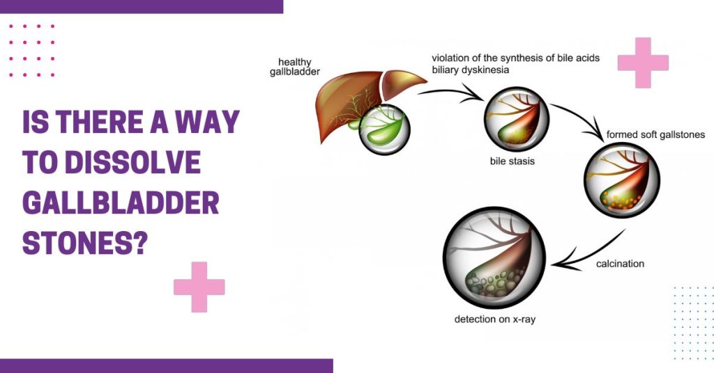 Is there a way to dissolve gallbladder stones? | Sri Ramakrishna Hospital