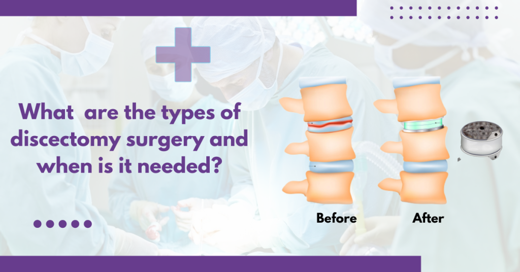 What Are The Types of Discectomy Surgery And When Is It Needed? | Sri ...