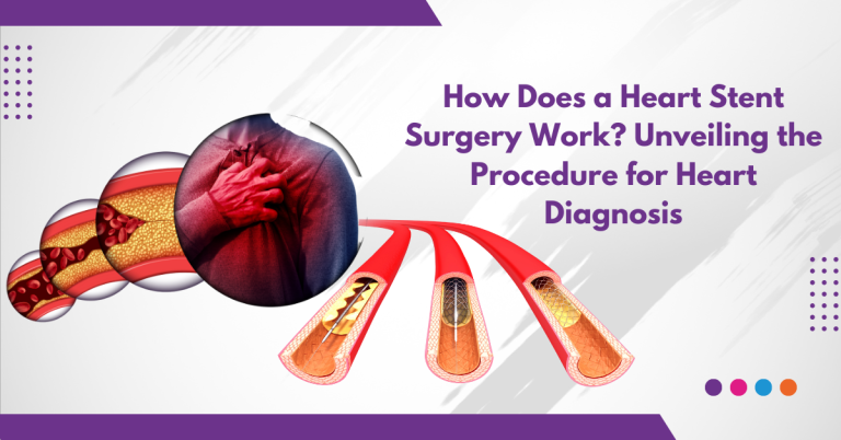 How Does a Heart Stent Surgery Work? Unveiling the Procedure for Heart Diagnosis