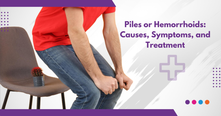Piles or hemorrhoids : Causes, Symptoms, and Treatment | Sri ...
