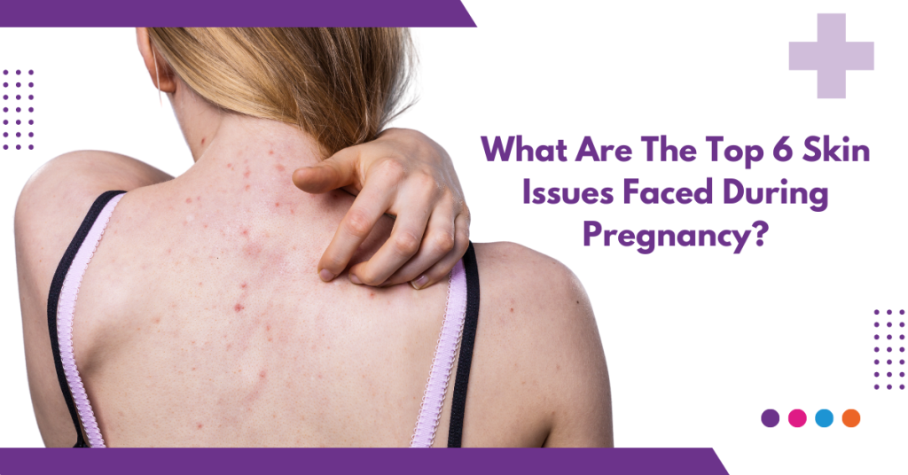 What Are The Top 6 Skin Issues Faced During Pregnancy?