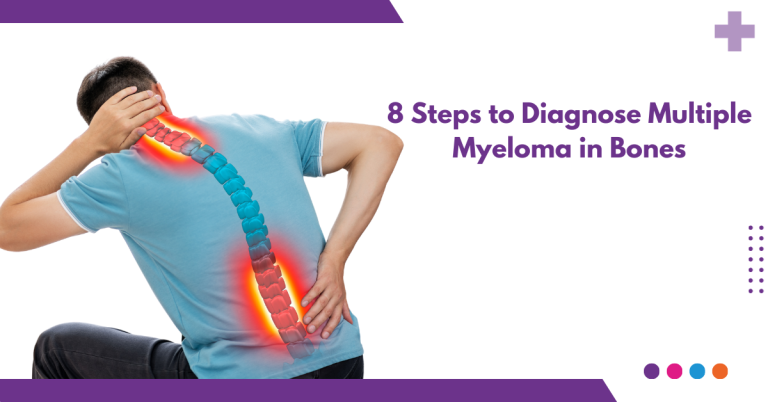 8 Steps to Diagnosing Multiple Myeloma in Bones