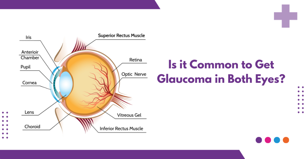 Is it common to get glaucoma in both eyes?