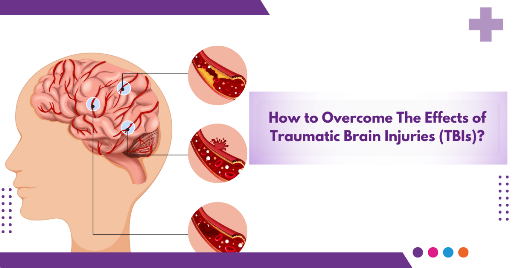 How to Overcome The Effects of Traumatic Brain Injuries (TBIs)?