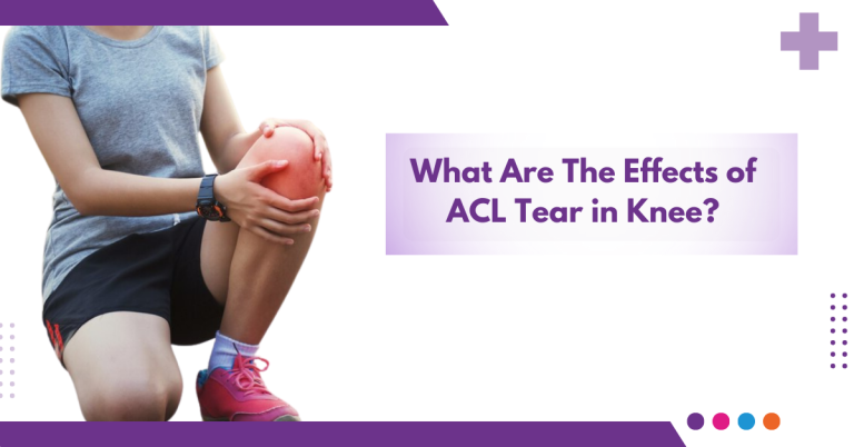 What Are The Effects of ACL Tear in Knee?