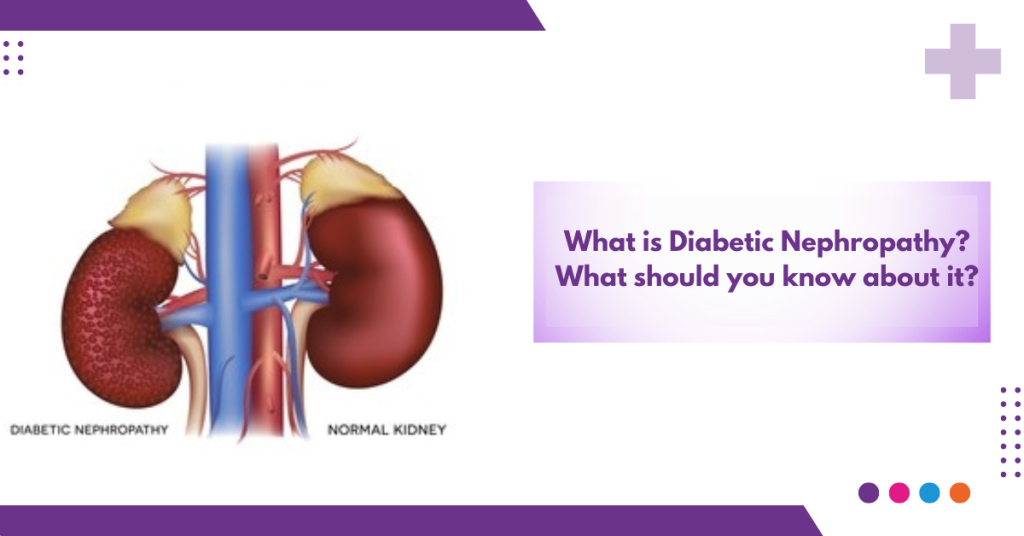 What is Diabetic Nephropathy? What Should You Know About it?