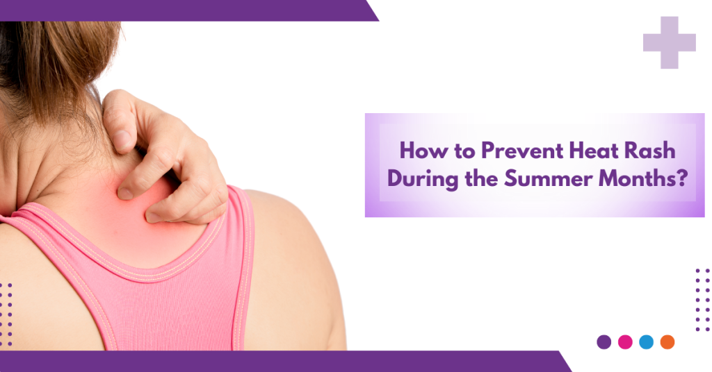 How to Prevent Heat Rash During the Summer Months?