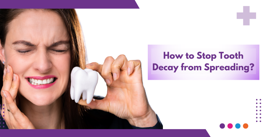 How to Stop Tooth Decay from Spreading?
