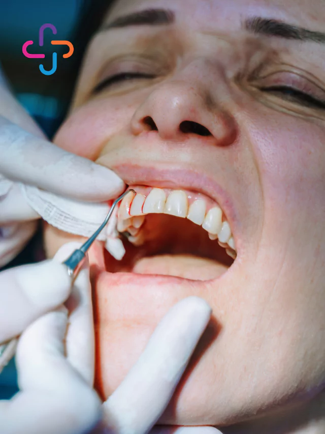 Foods That Can Damage Teeth What You Should Be Aware Of - Sri ...