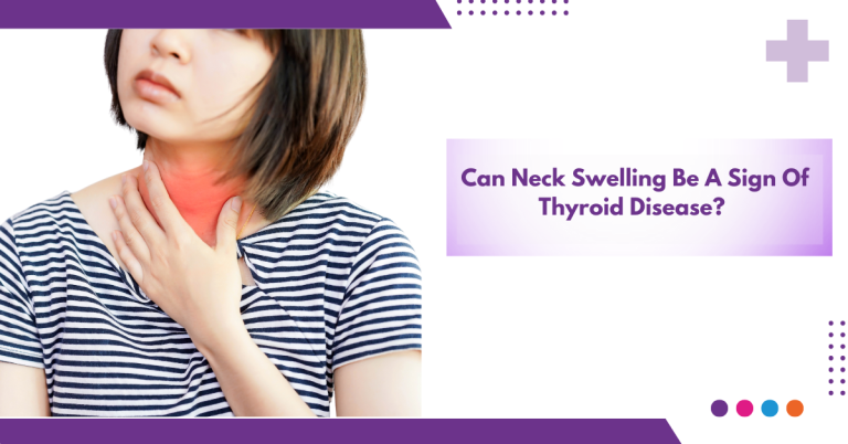 Can Neck Swelling Be A Sign Of Thyroid Disease?