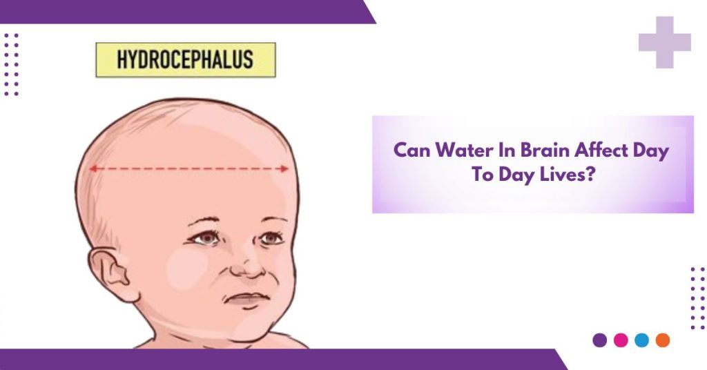 Can water in brain affect day to day lives