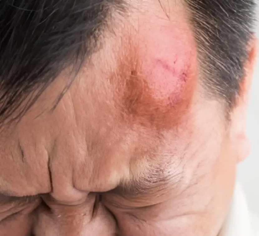 Polytrauma | Best Hospital for Head Injury in Coimbatore