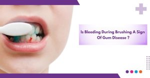 Is Bleeding During Brushing A Sign Of Gum Disease