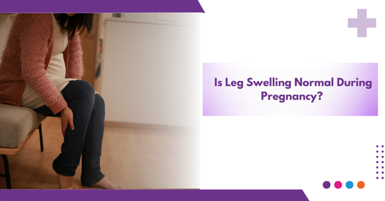 Is Leg Swelling Normal During Pregnancy? - Sri Ramakrishna Hospital
