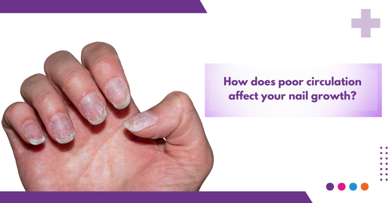 How Does Poor Circulation Affect Your Nail Growth? - Sri Ramakrishna ...