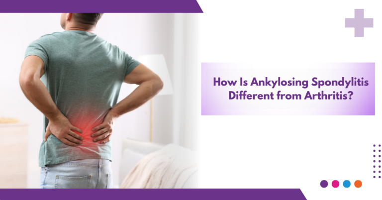 How Is Ankylosing Spondylitis Different from Arthritis? - Sri ...
